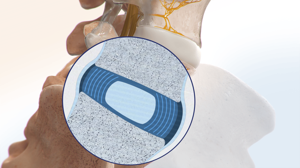 AZ Pain Doctors | Intracept