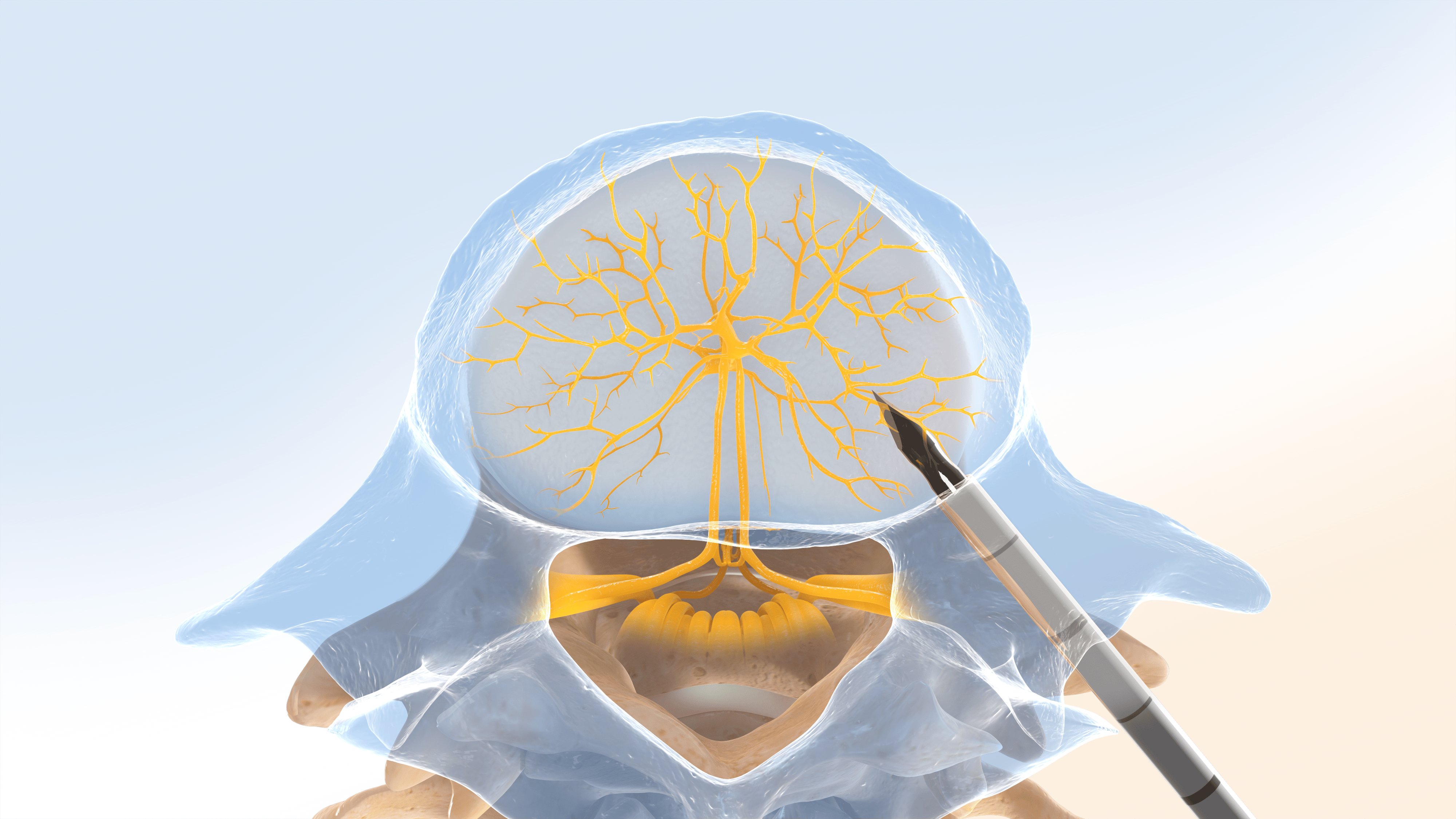 AZ Pain Doctors | Intracept